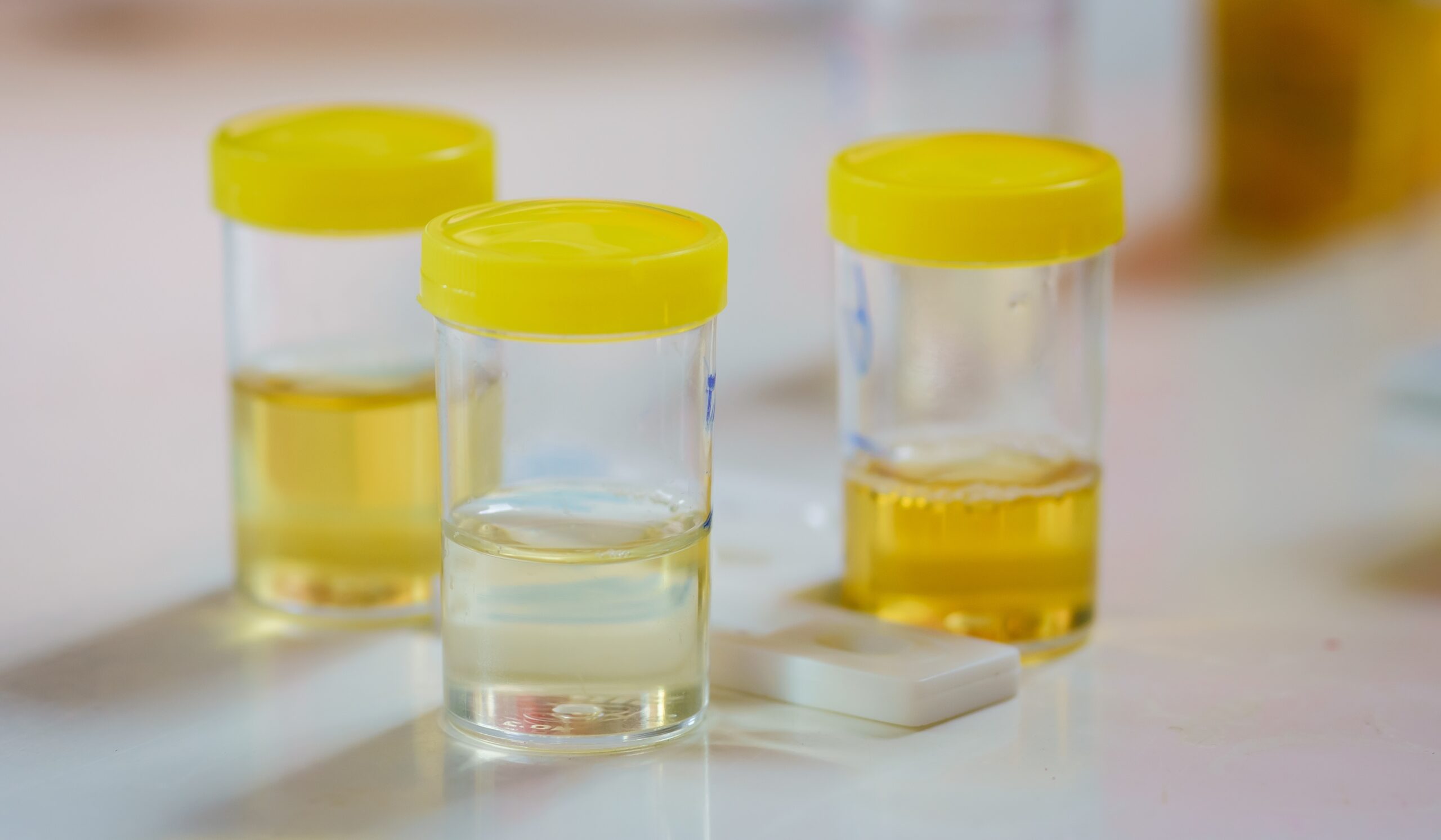 Urine temperature indicators for SAMHSA drug testing